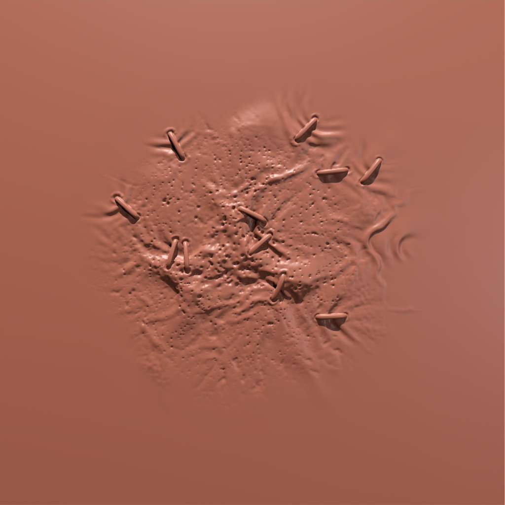 Scar with Stitches and Staples | scars & wounds brushes | BlenderKit